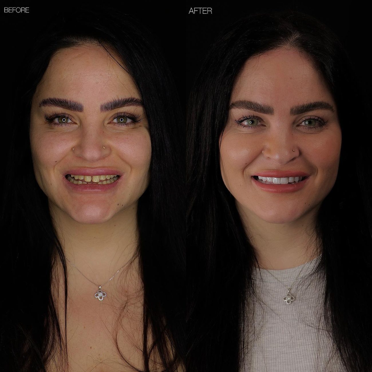 Plastic Surgery – Be you clinics Radiant Revive: Transforming ...